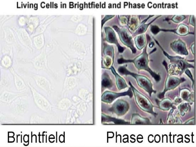 phase contrast microscope