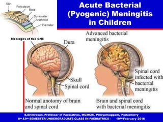 acubacterialmeningitis18feb-160314072922-converted.pptx