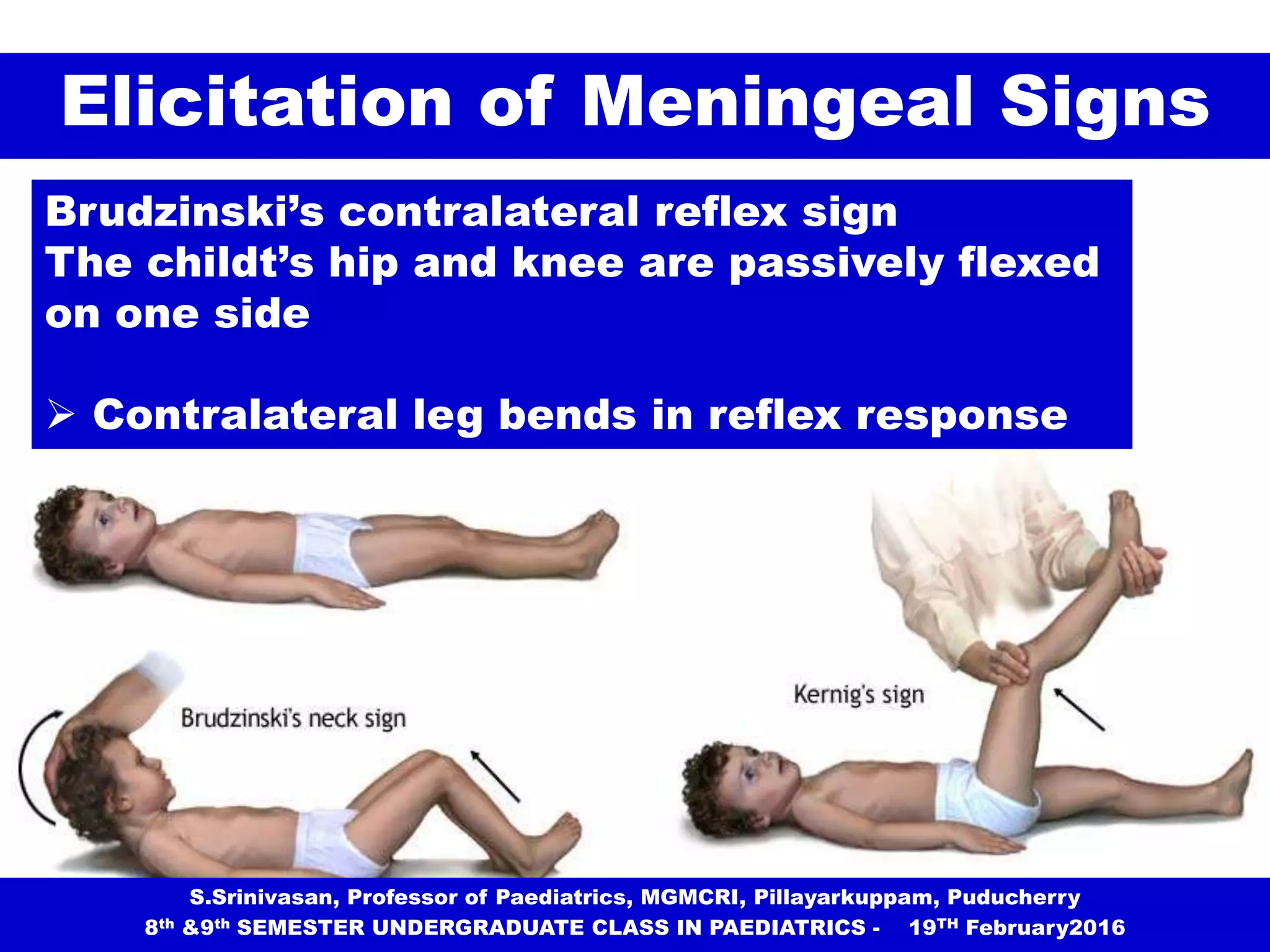Acute bacterial (Pyogenic) meningitis - Dr. S. Srinivasan, Professor of ...