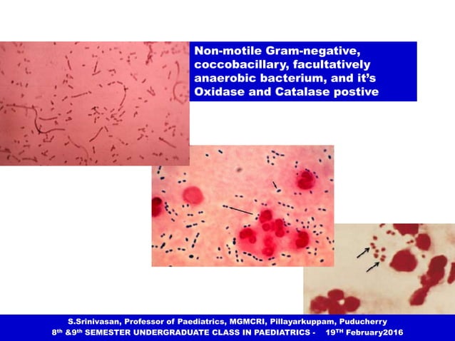 Acute bacterial (Pyogenic) meningitis - Dr. S. Srinivasan, Professor of ...