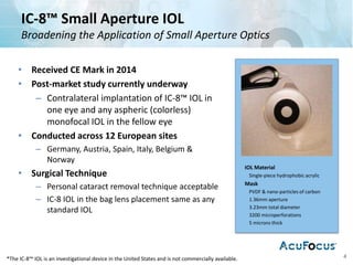 Acufocus | PPT