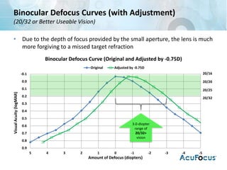 Acufocus | PDF