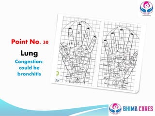 Acupressure iv How to find out about the type of Fever | PPTX ...