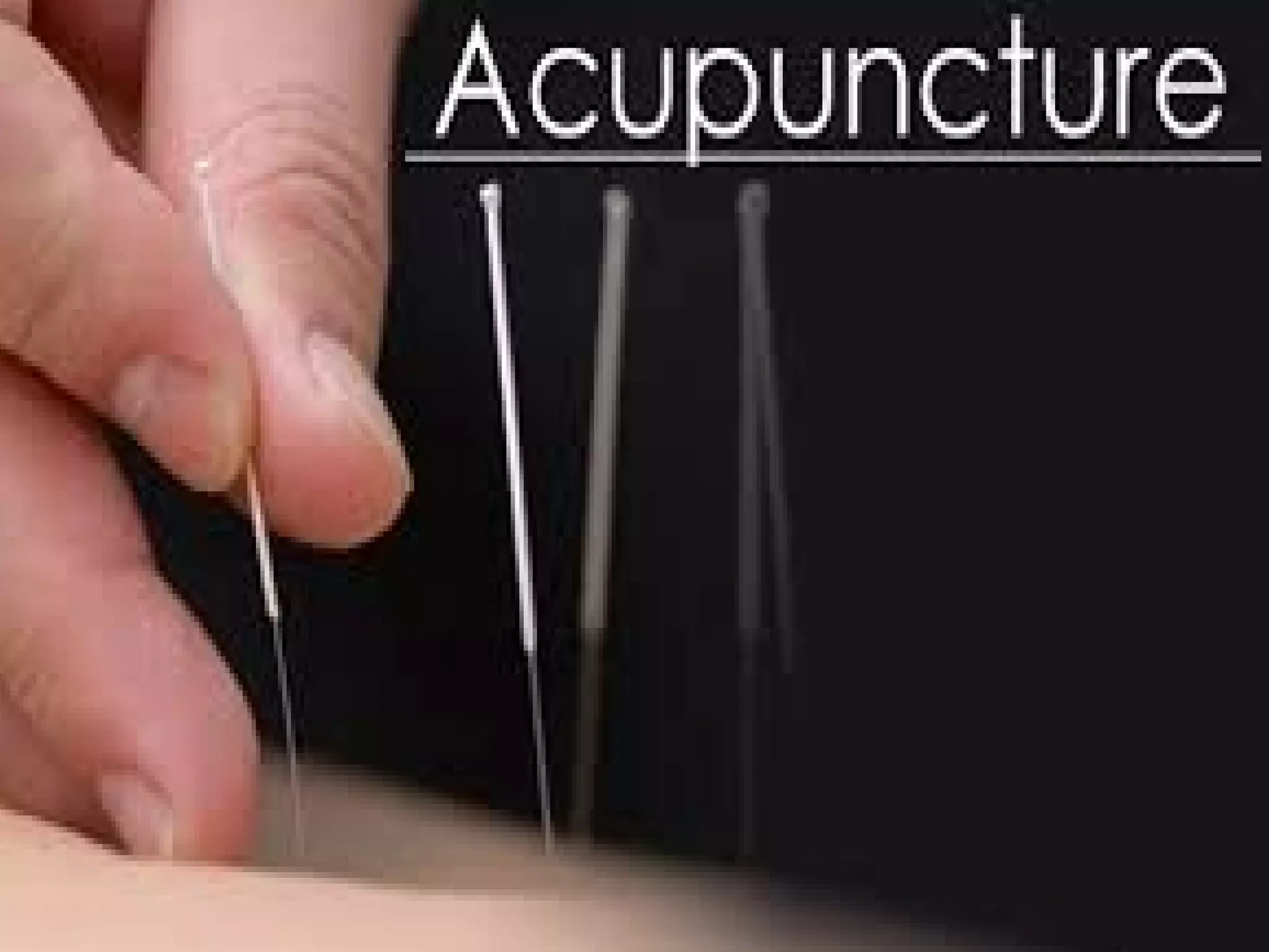 Acupressure & acupuncture | PPT
