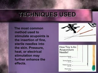 Acupressure & acupuncture | PPT