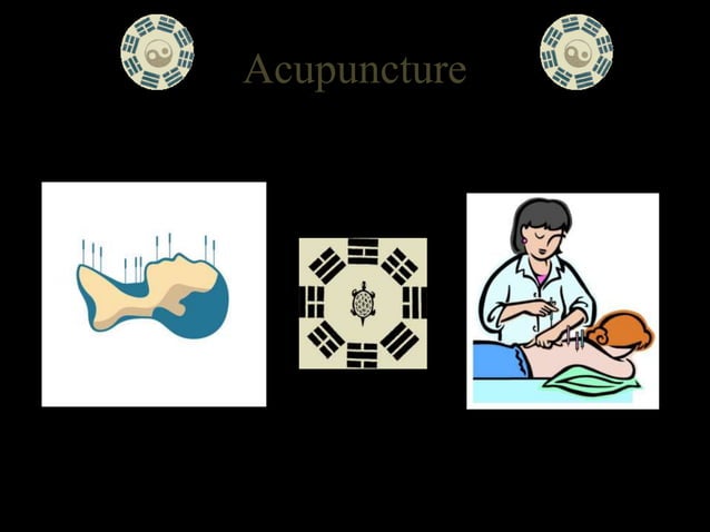 Acupuncture | PPT