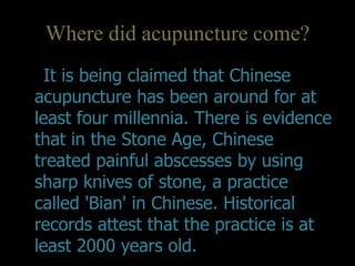 Acupuncture | PPTX