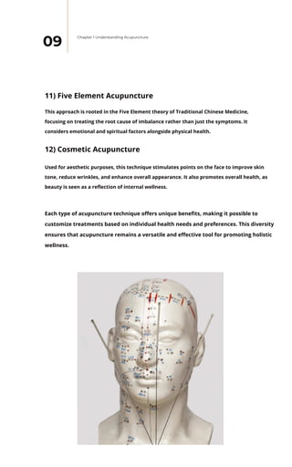 Acupuncture: Pathway to a Healthier Life | PDF