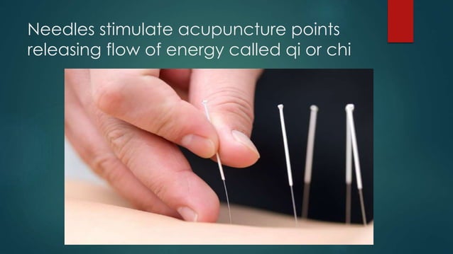 Acupuncture | PPTX | Alternative Medicine | Wellness