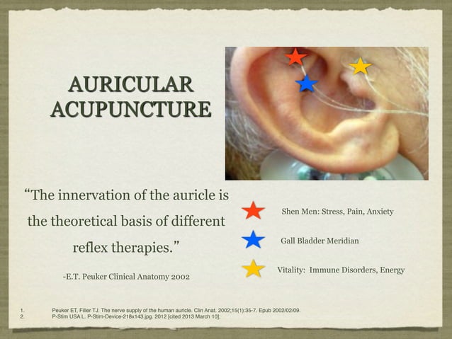 Acupuncture PStim Power Point | PPT