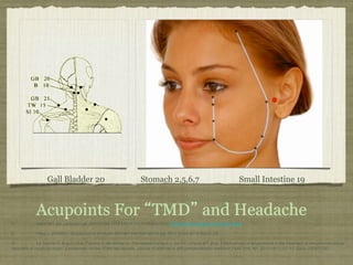 Acupuncture PStim Power Point | PPT