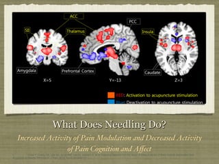 Acupuncture PStim Power Point | PPT
