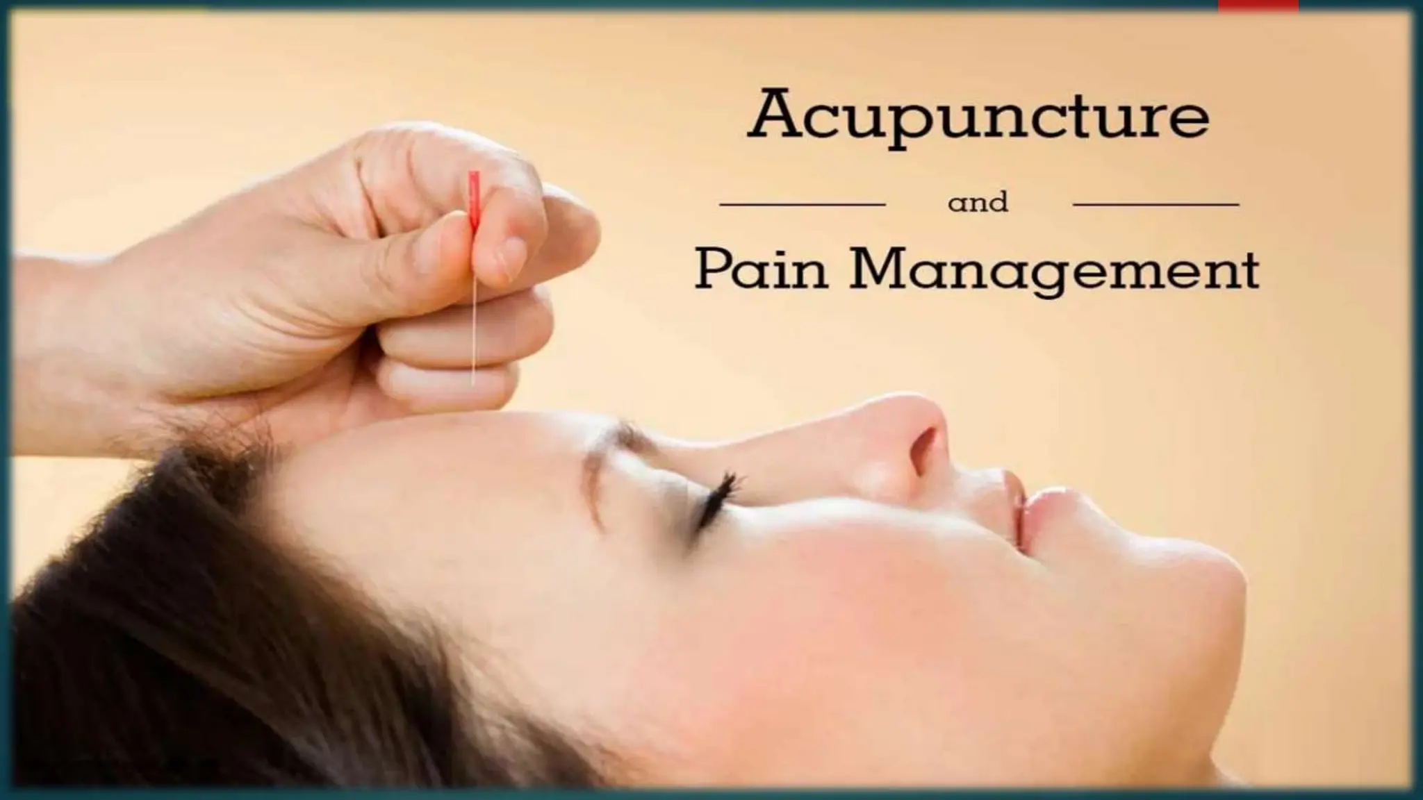 Acupuncture for Pain Management At Endpoint Wellness.pptx