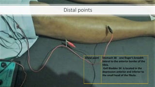 Acupuncture frozen shoulder | PPTX