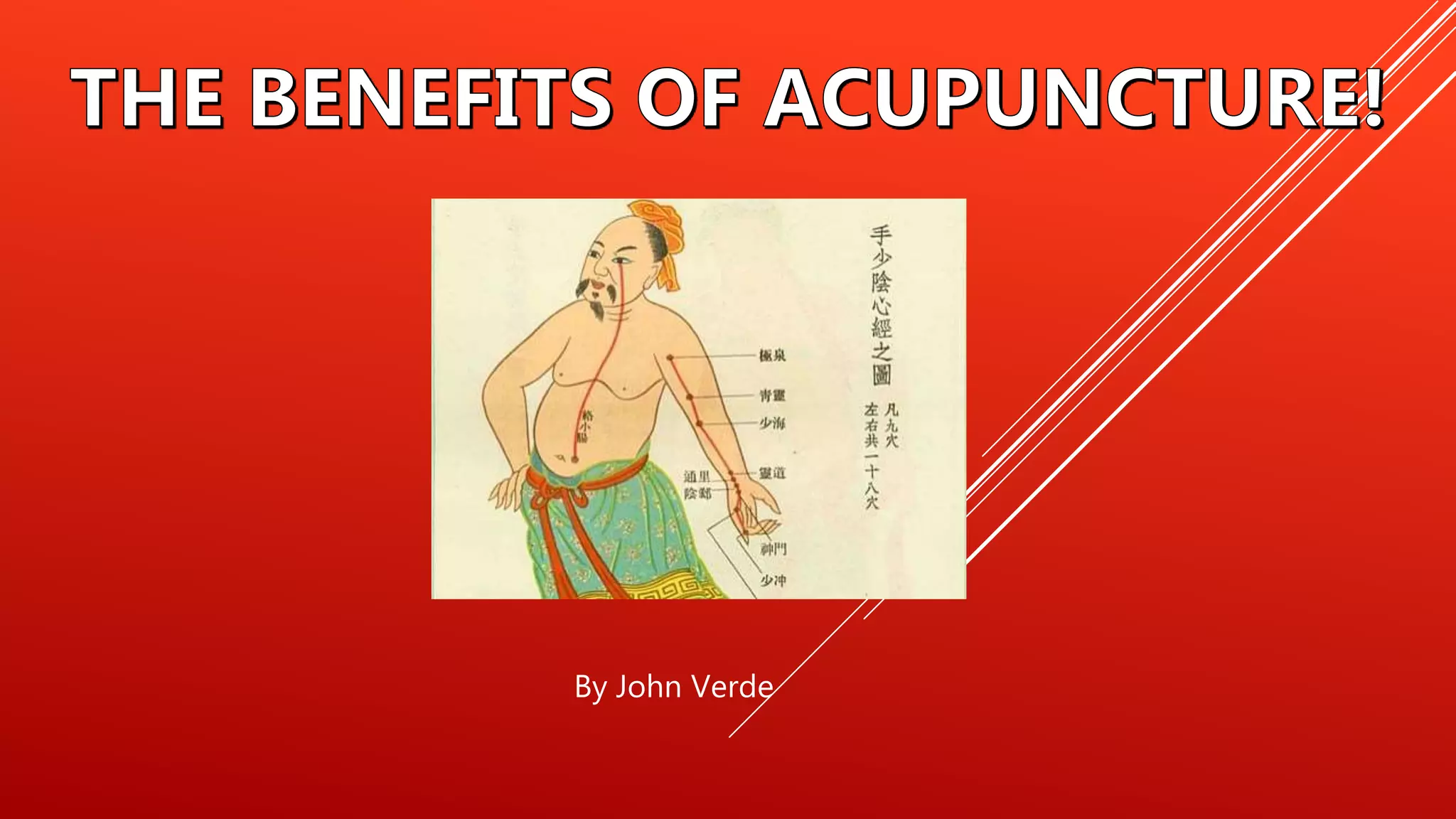 Acupuncture presentation | PPTX