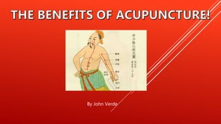 Acupuncture presentation | PPTX