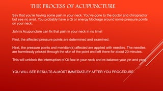 Acupuncture presentation | PPTX