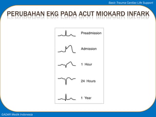 Acut Coronary | PDF