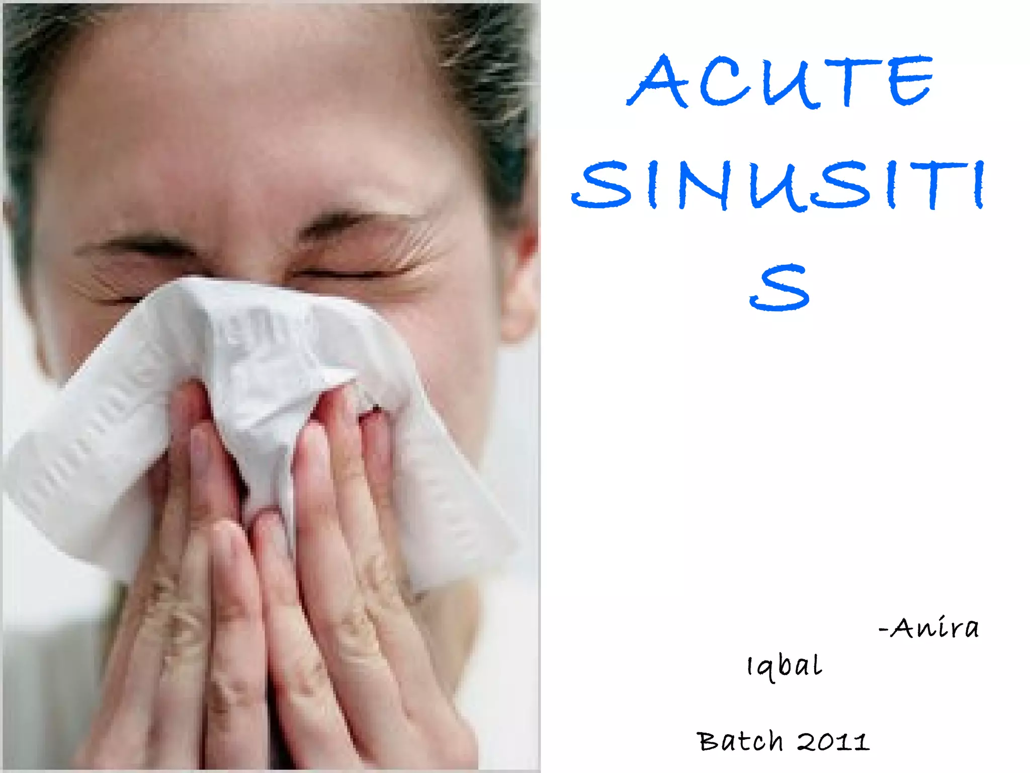 Acute Sinusitis | PPT