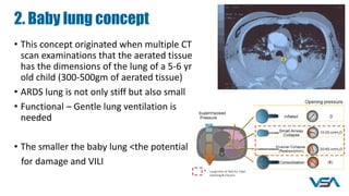 Acute respiratory distress syndrome | PPTX
