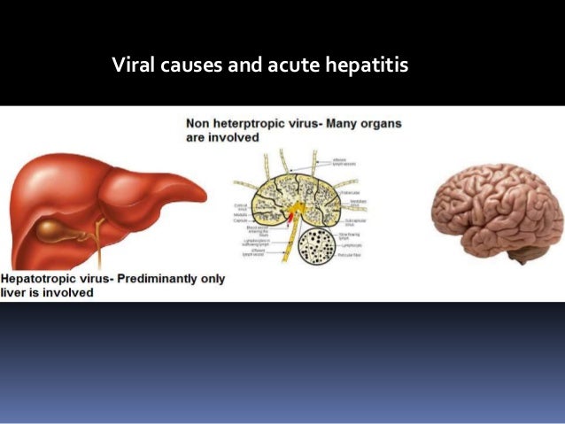 Acute hepatitis