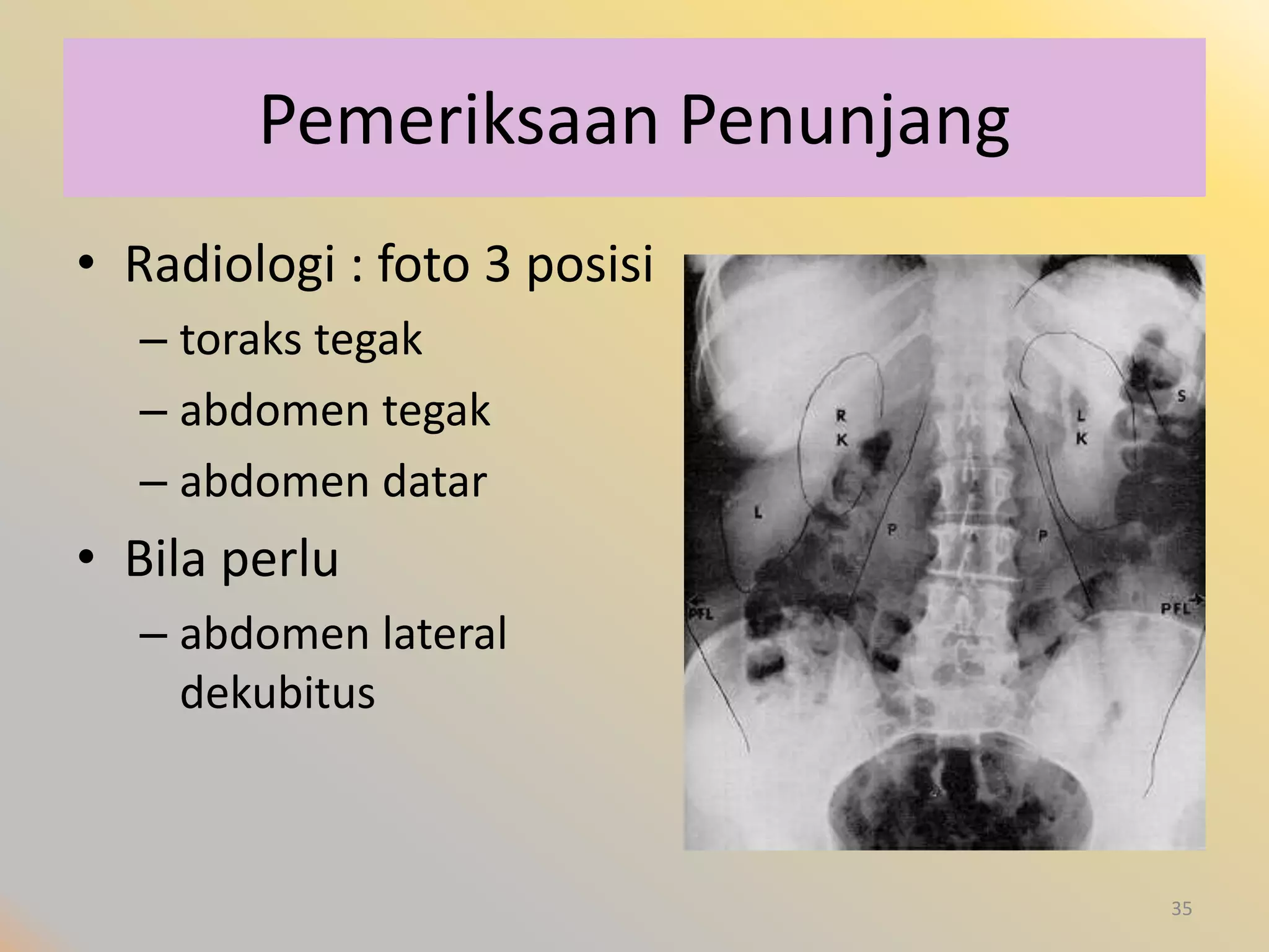 Acute-Abdomen-PPT.pptx
