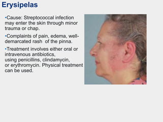 Acute and chronic middle otitis prophylaxis | PPT