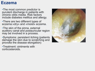 Acute and chronic middle otitis prophylaxis | PPT