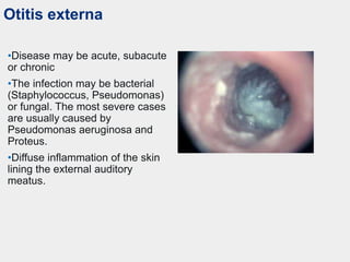 Acute and chronic middle otitis prophylaxis | PPT