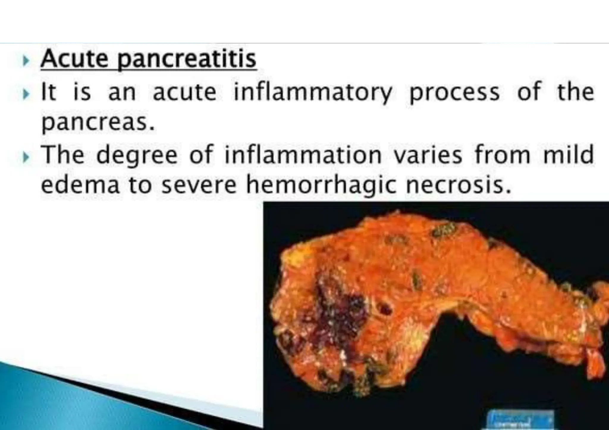 acute-and-chronic-pancreatitis-1-638.pptx_20240310_045509_0000.pptx ...