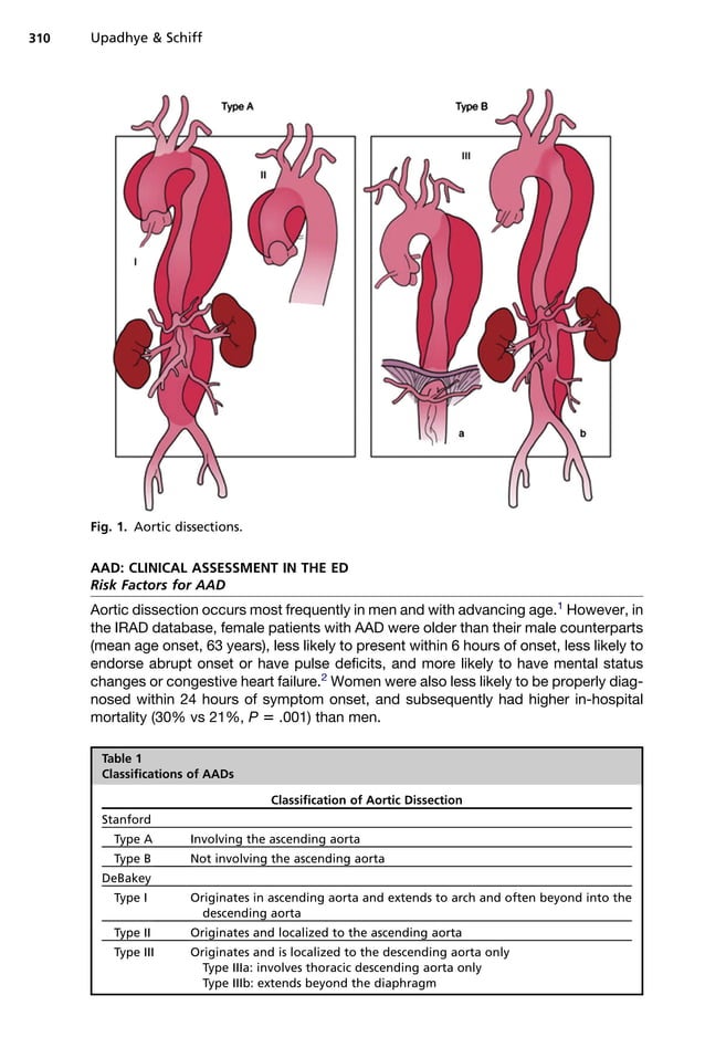 Acute aortic dissection in the emergency department - Emergency ...