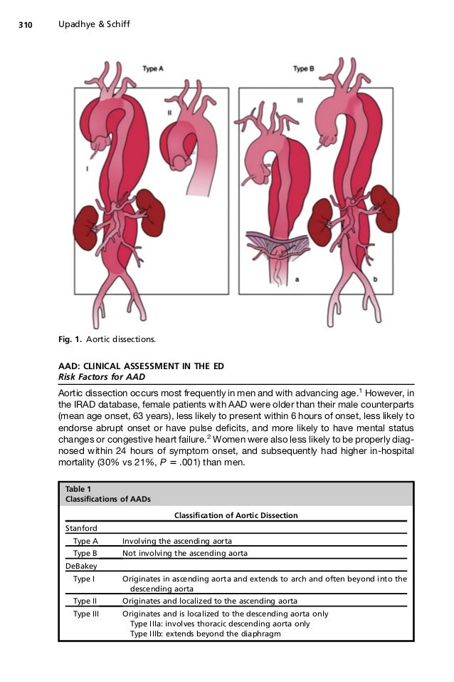 Acute aortic dissection in the emergency department - Emergency Medic…