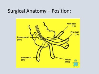 ACUTE APPENDICITIS | PPTX | Digestive Disorders | Diseases and Conditions