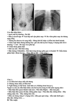 Acute bs th-ng | DOC