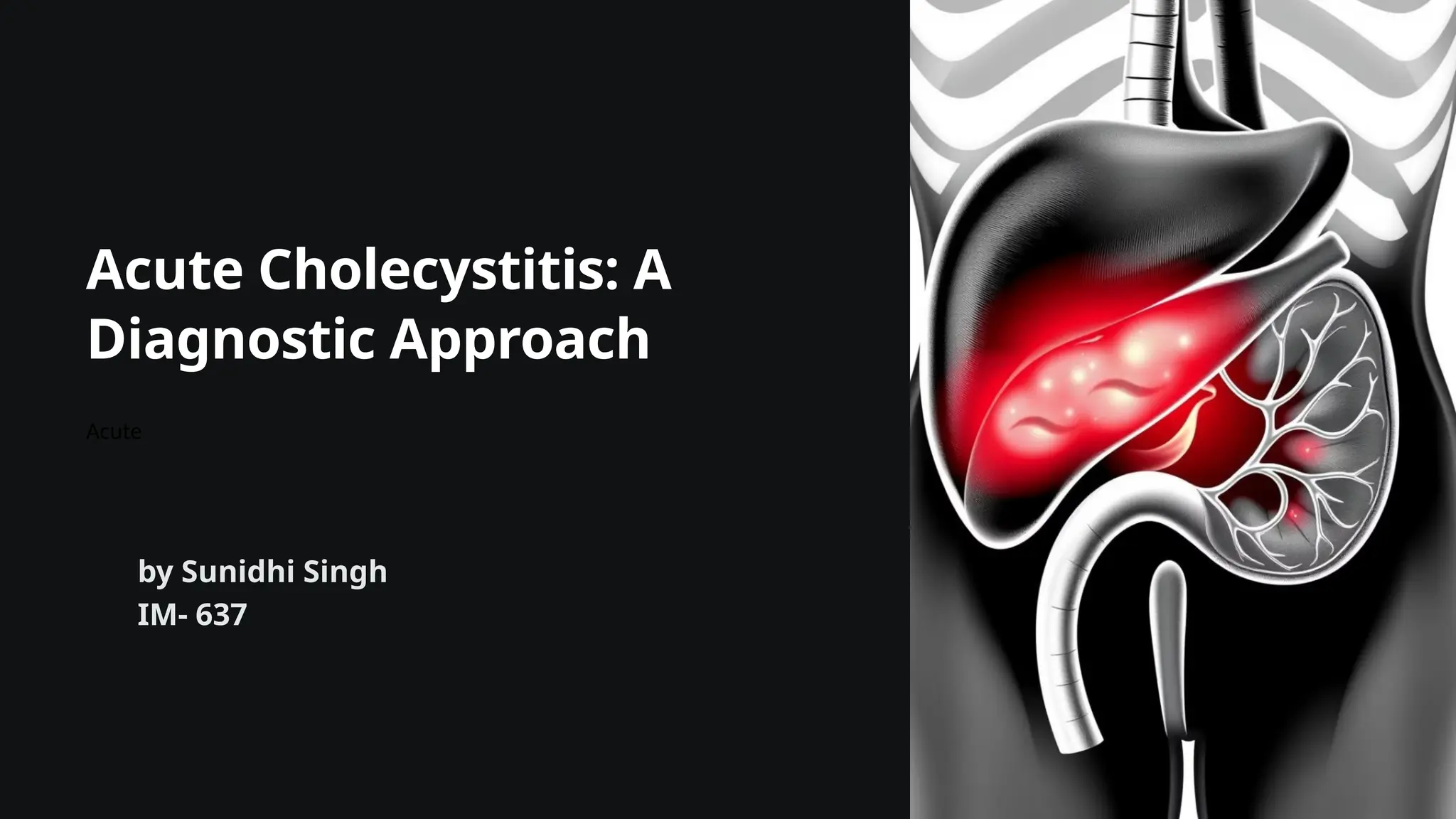 Acute Cholecystitis-A Diagnostic Approach | PPTX