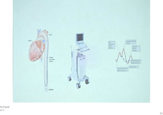 Acute-Chronic-Heart-Failure.pdf everything to know . | PDF