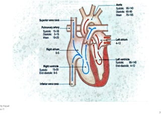 Acute-Chronic-Heart-Failure.pdf everything to know . | PDF