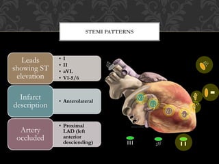 Acute Coronary Syndrome and the ECG | PPTX