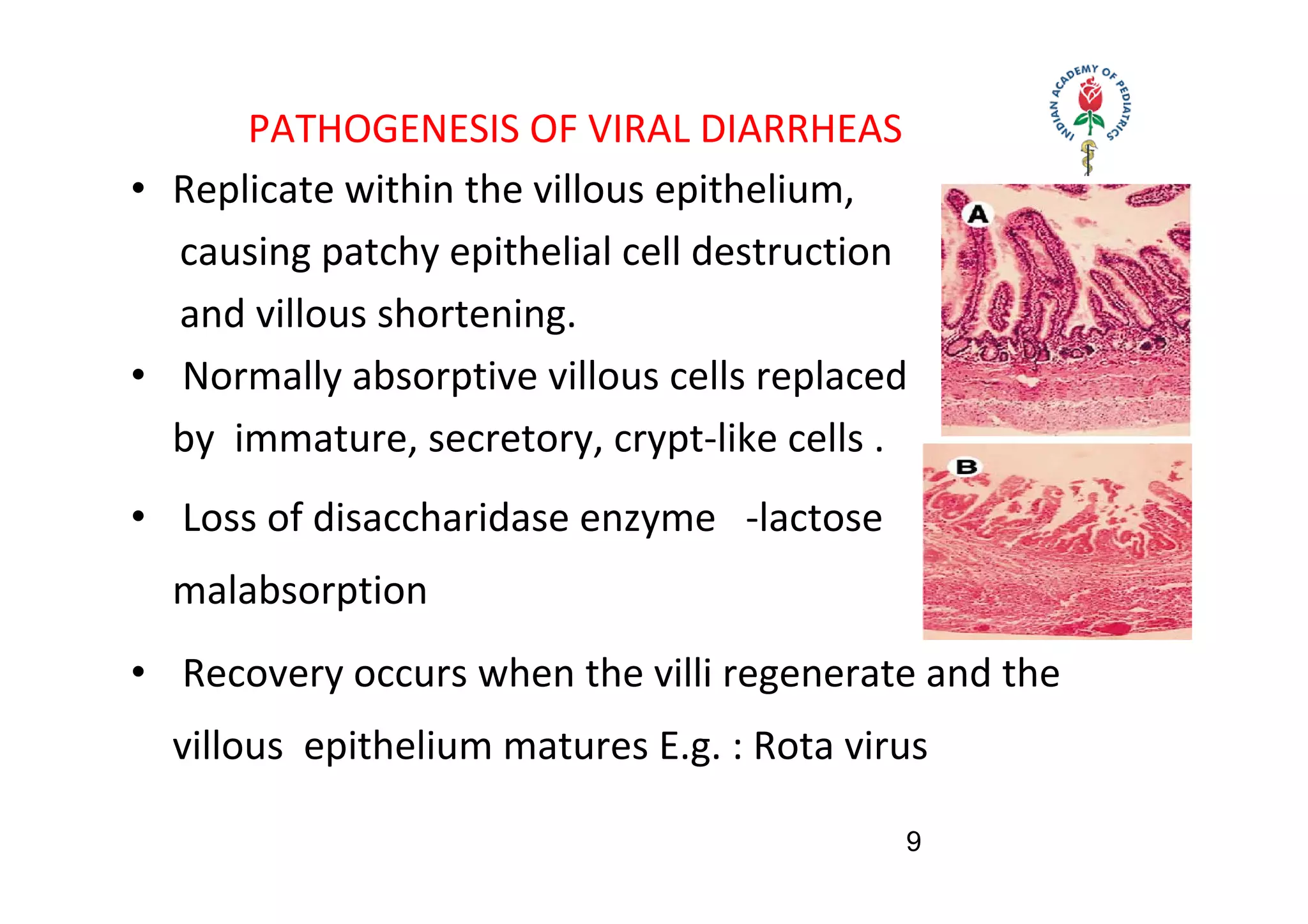 Acute-Diarrhoeal-Diseases.pdf