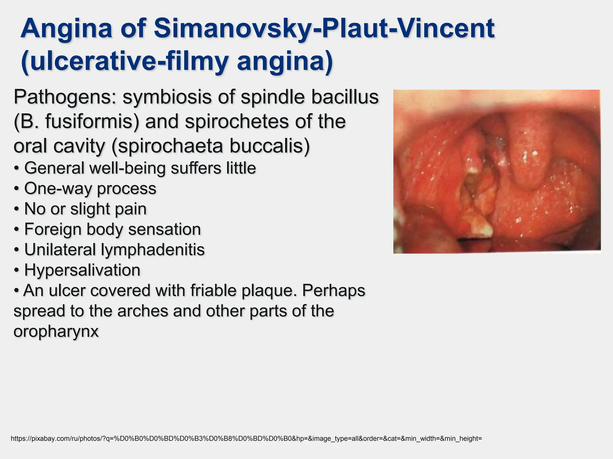 Acute-diseases-of-pharynx_Acute-diseases-of-pharynx | PPT