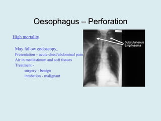 Acute gastrointestinal-emergencies-1232208980905009-3 | PPT