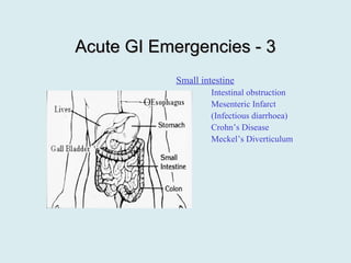 Acute gastrointestinal-emergencies-1232208980905009-3 | PPT