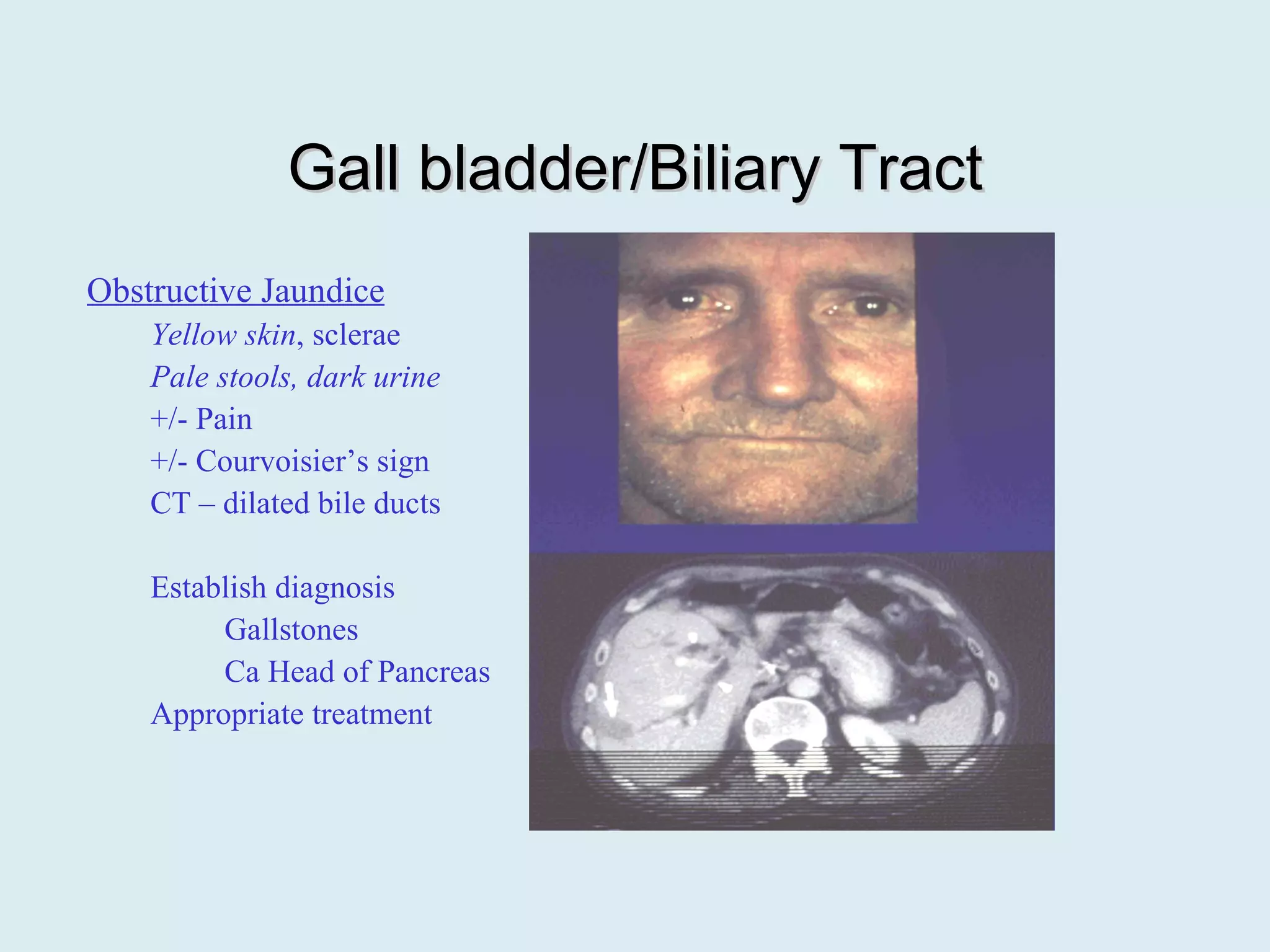 Acute Gastrointestinal Emergencies | PPT