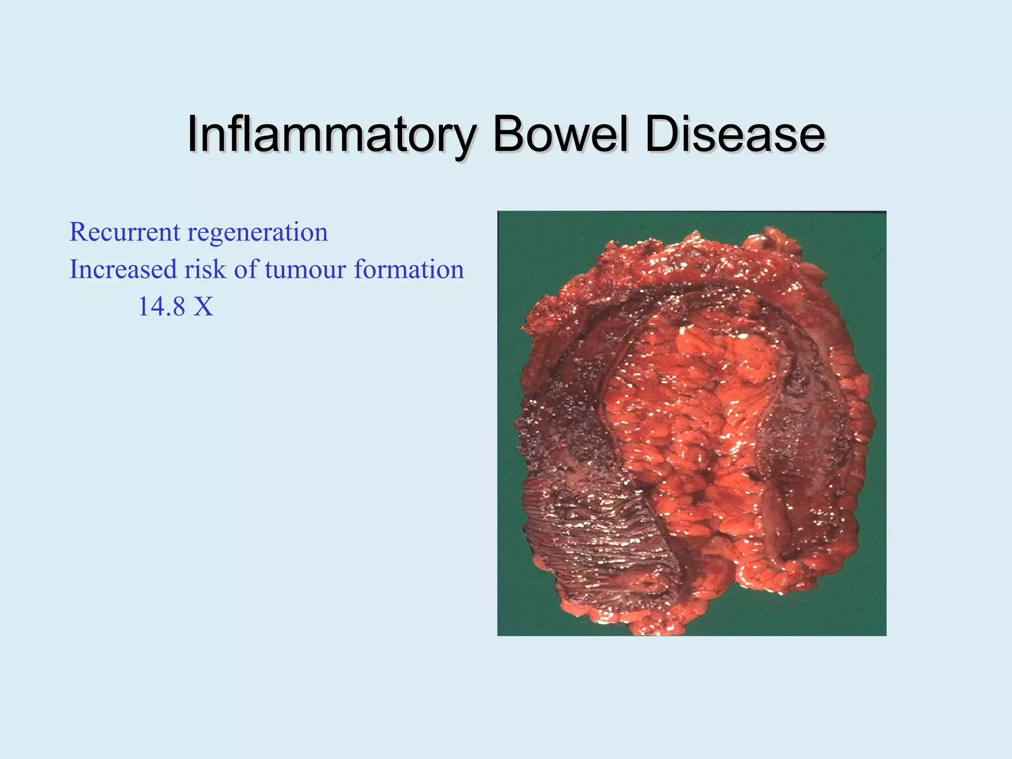 Acute Gastrointestinal Emergencies | PPT