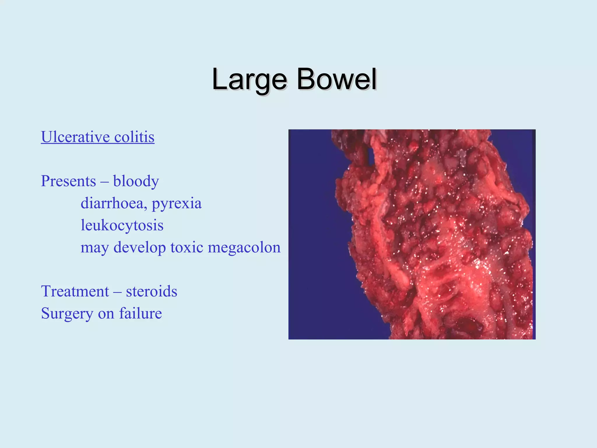 Acute Gastrointestinal Emergencies | PPT