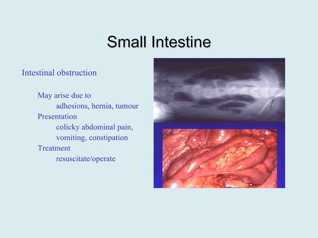 Acute Gastrointestinal Emergencies | PPT | Digestive Disorders ...