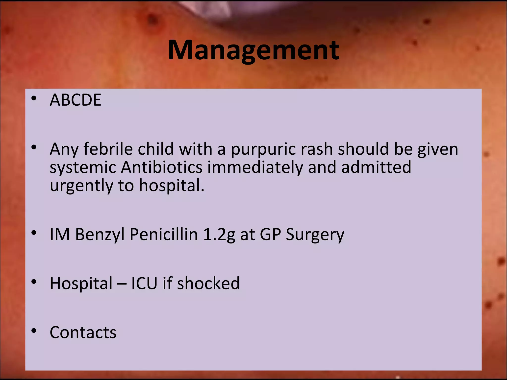 Acute Meningococcaemia | PPT