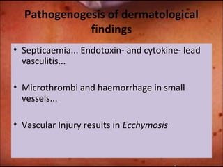 Acute Meningococcaemia | PPT