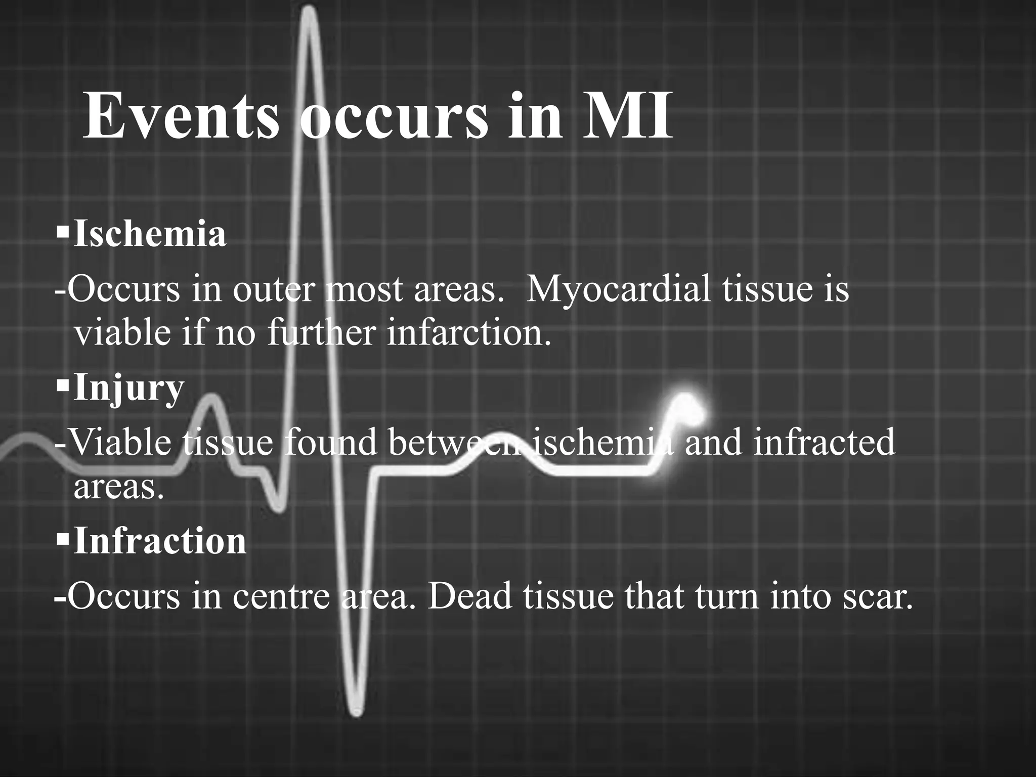 Acute myocardial-infraction | PPTX