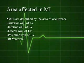 Acute myocardial-infraction | PPTX | Heart and Cardiovascular Diseases ...